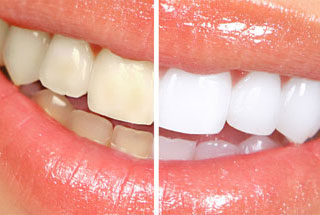 Dentist in Memphis TN Germantown Dental Group